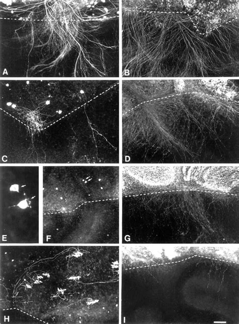 Axonal Regeneration Of Purkinje Cells In The Presence Or Absence Of