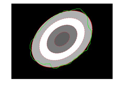Texture Feature Extraction For An Atypical Lesion First A Grid Download Scientific Diagram