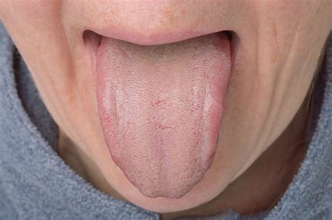Does Tongue Scraping Help Promote Proper Oral Hygiene We Asked A Dentist South China Morning Post