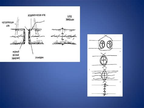 Оперативная хирургия нижней конечности Топографическая анатомия шеи Online Presentation