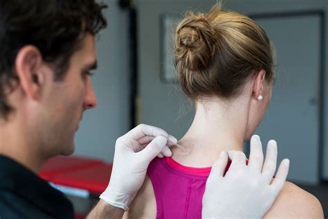 Trigger Point Dry Needling