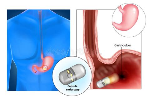 Egd Stock Illustrations 244 Egd Stock Illustrations Vectors