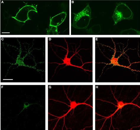 Palmitoylation And Hence Membrane Association Is Required For The