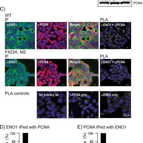 Targeting Protein Pcna Interactions In Haematological Cells Reduced Download Scientific
