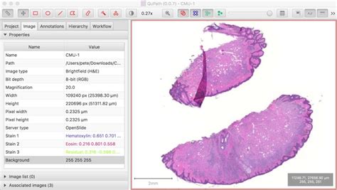 Preprocessing Qupath Qupath Wiki GitHub