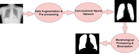 Proposed Lung Segmentation Model Download Scientific Diagram