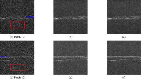 Figure 1 From Deep Learning For Unsupervised Denoising Of Radar Sounder Data Semantic Scholar