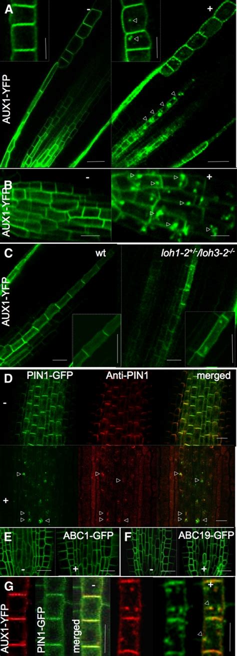 Sphingolipids Containing Very Long Chain Fatty Acids Define A Secretory