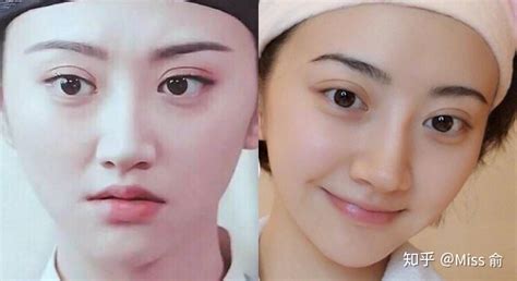 郑州双眼皮自然风格的医生有哪些？ 知乎