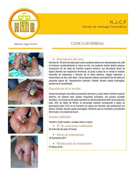 Caso Clínico Heridas N8 ANGGY FERREIRA MANTILLA uDocz