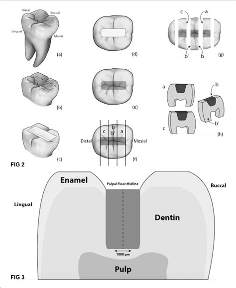 Figure 2 From Comparison Of Internal Adaptation Of Bulk Fill And
