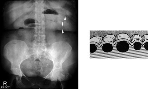 Dr Herry Setya Yudha Utama Spb Finacs Mhkes Ics Digestive Surgery
