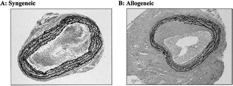 Control Aortic Grafts On Day 40 Post Transplantation A Syngeneic