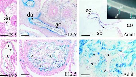 Differences In β β β β β Galactosidase Activity During Development And