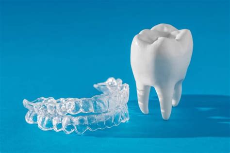 Can Invisalign Fix Overbite And How Long Does It Take
