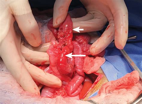 Intussusception Reduction