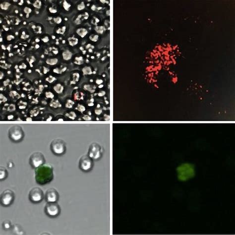 Upper Panel Single Endothelial Progenitor Cell With Double Marker Download Scientific Diagram