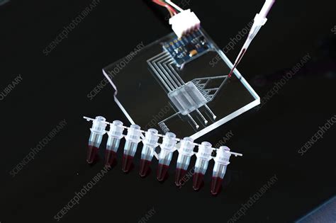 Lab On A Chip Stock Image F021 3987 Science Photo Library