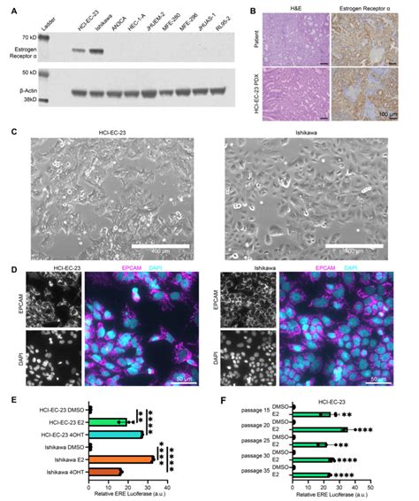 Hci Ec 23 Is An Epithelial Endometrial Cancer Cell Line Expressing Er