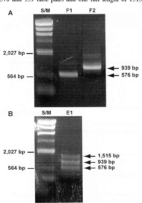 Figure 1 From Modification Of Overlap Extension Pcr A Mutagenic Approach Semantic Scholar