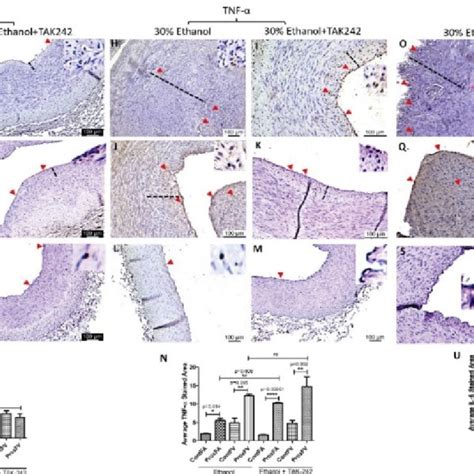 Figure S2 Immunohistochemistry For Interleukin Il 8 Tumor Necrosis