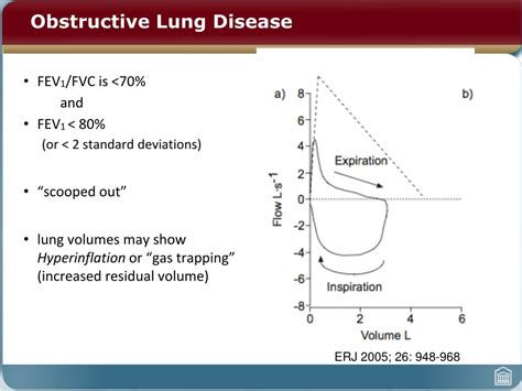 Ppt Back To Basics Review Respirology In Under Two Hours Powerpoint Presentation Id 3299186