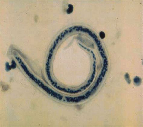 Examples Of Filarial Worms