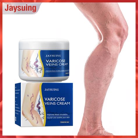 Jaysuing Varicose Veins Cream For Treating Varicose Vasculitis