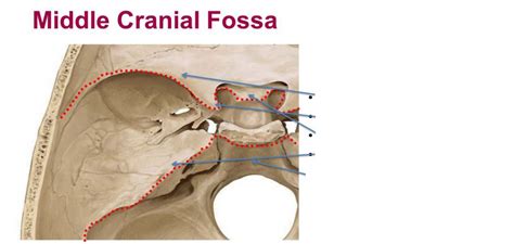 Middle Cranial Fossa 1 Diagram Quizlet