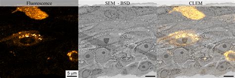 Correlated Array Tomography Workshop Scilifelab