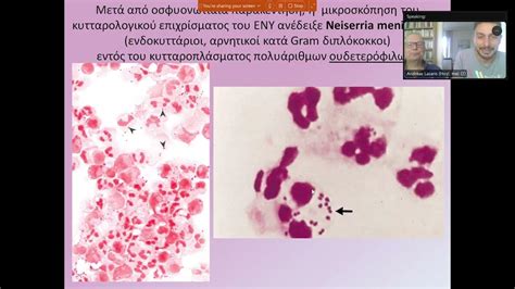 ΕΙΣΑΓΩΓΗ ΣΤΟ ΚΥΚΛΟΦΟΡΙΚΟ ΣΥΣΤΗΜΑ ΚΑΙ ΒΡΑΧΕΙΑ ΠΑΡΟΥΣΙΑΣΗ 1ου ΠΕΡΙΣΤΑΤΙΚΟΥ Youtube