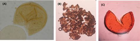 Frontiers Exploring The Mycobiome And Arbuscular Mycorrhizal Fungi