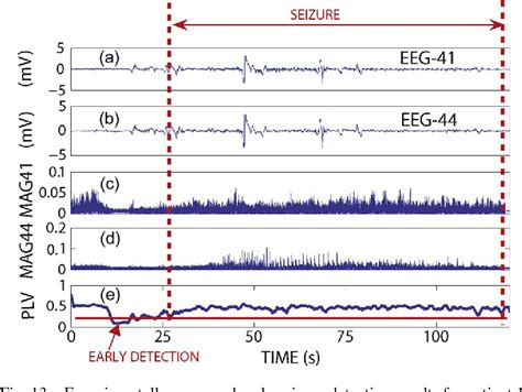 Figure 13 From Phase Synchronization Early Epileptic Seizure Detector Vlsi Architecture