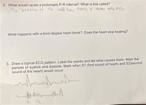 Solved What Would Cause A Prolonged P R Interval What Is
