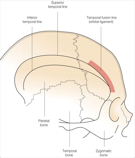 Superior Temporal Line
