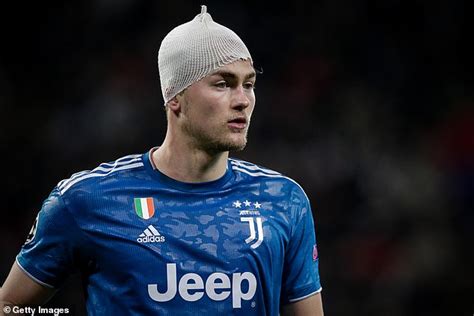 Fans React As Matthijs De Ligt Sustains Nasty Head Injury In Juventus