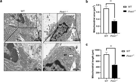 Morphology Of Mitochondria In Osteoblasts And Osteocytes Of Femurs From