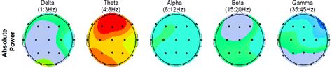 QEEG Brain Maps Southern Psychology Neurotherapy