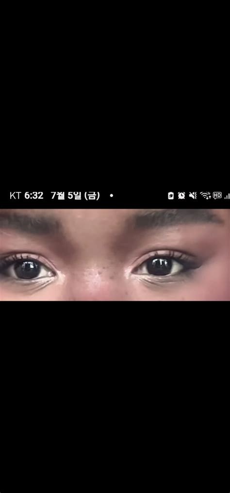 쌍커풀 수술 쌍수 아웃라인 지식in