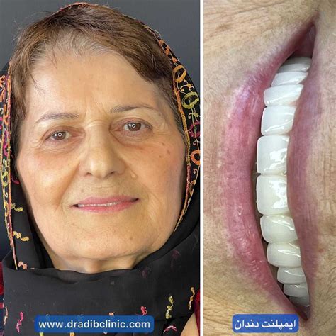 گالری دندانپزشکی دکتر ادیب