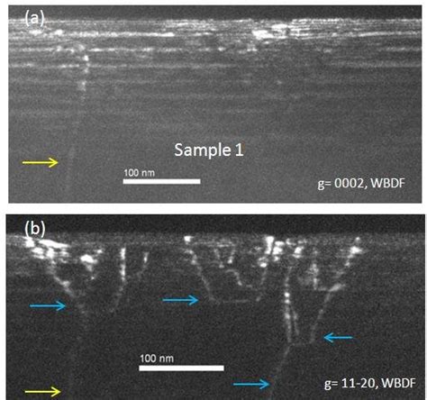 Dislocation Analysis Of Sample 1 Weak Beam Dark Field Image Wbdf Download Scientific Diagram