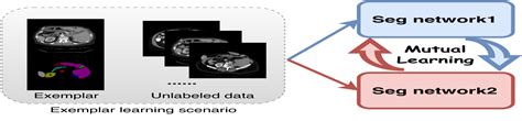 crossmatch enhance semi supervised medical image segmentation with