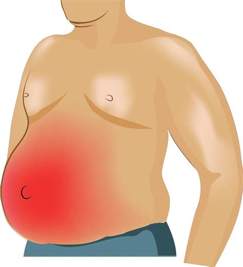 17 Vectores De Stock Y Arte Vectorial De Ascitis Shutterstock