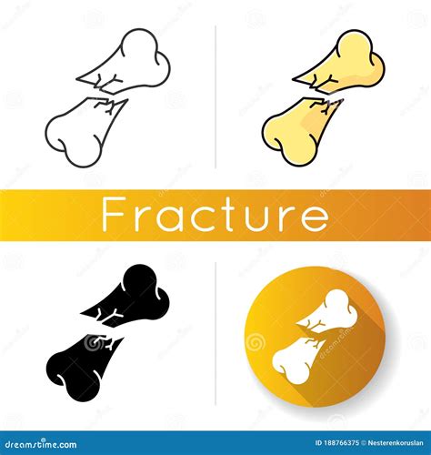 Oblique Fracture Of The Tibia Leg Fracture 3d Illustration
