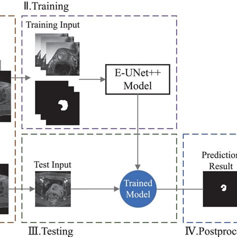 Automatic Cervical Cancer Segmentation In Multimodal Magnetic Resonance