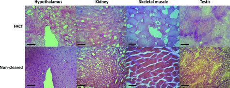 Comparison Of Different Hematoxylin And Eosin Stained Tissues After