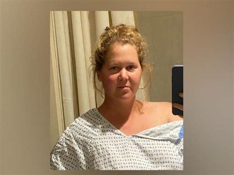 Amy Schumer Has Her Uterus And Appendix Removed Due To Endometriosis