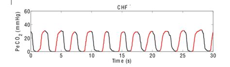 Training Day 3 Waveform Capnography Scenarios Capnoacademy Capnoacademy