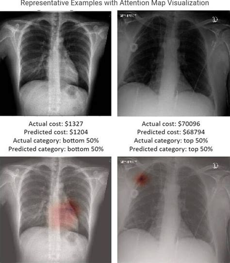 A Series Of Cxr Based Deep Learning Models To Predict Future Healthcare
