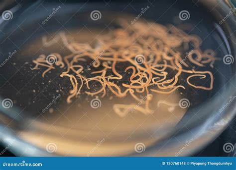 Ascariasis Is A Disease Caused By The Parasitic Roundworm Ascaris